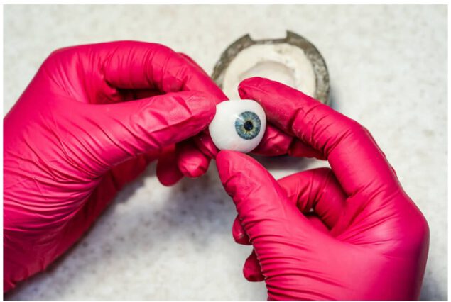 Ocular Prosthesis: Restoring Vision and Aesthetics with Artificial Eyes ...